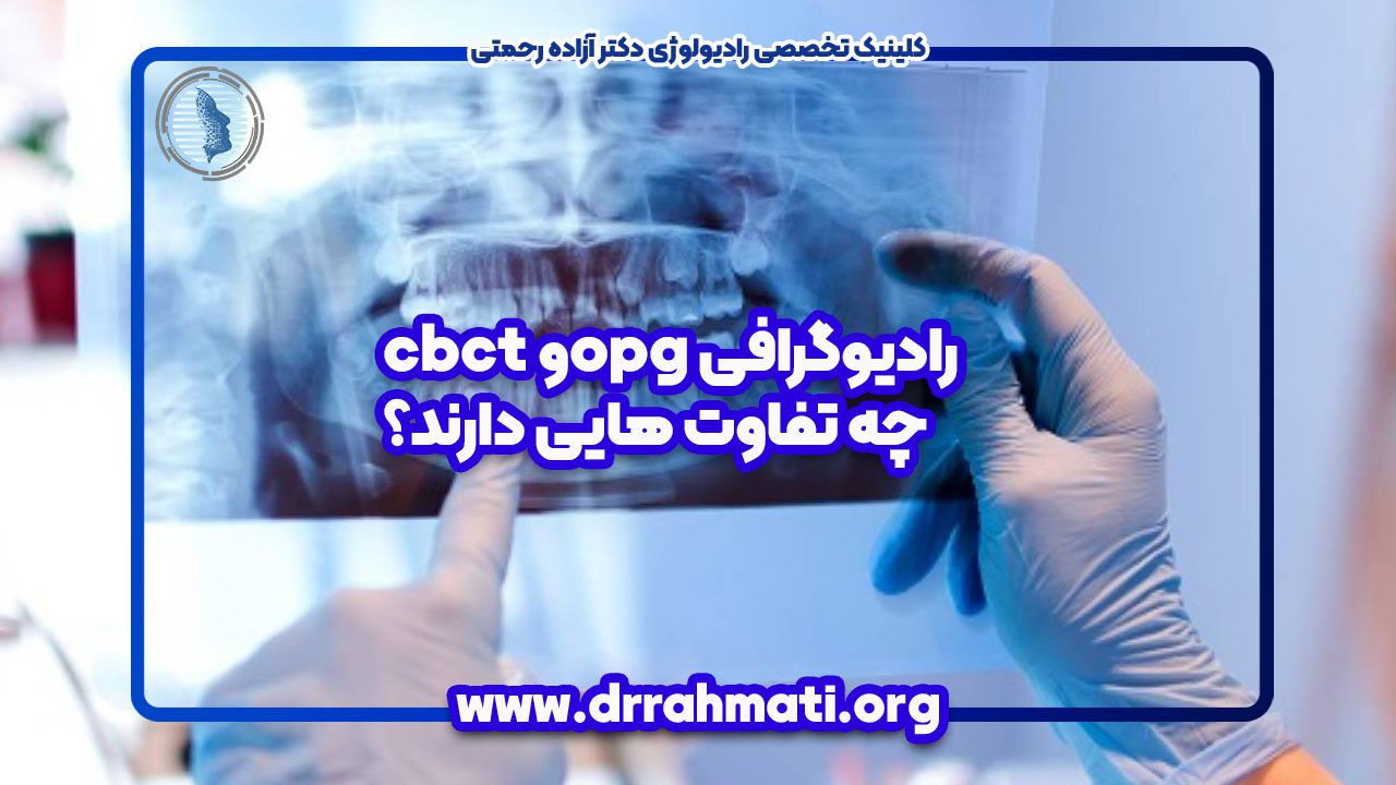 مقایسه 6 تفاوت رادیوگرافی opg و cbct